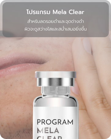 โปรแกรม Skin Booster เพิ่มความชุ่มชื้นให้ผิวเปล่งปลั่ง