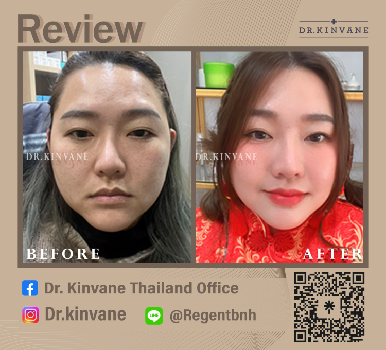 regentbnh - regentbnh