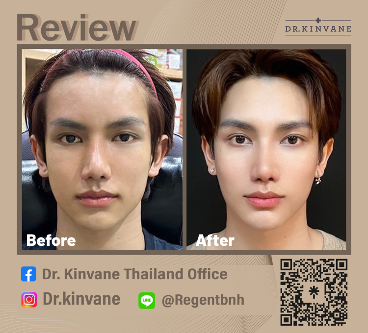 regentbnh - regentbnh