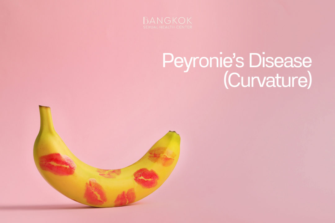 Peyronies Disease (Curvature) | BSHC