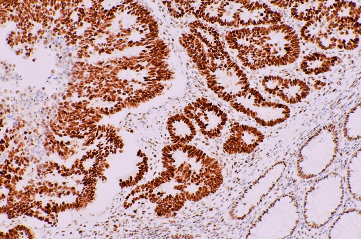 Immunohistochemistry Analyzer - imed