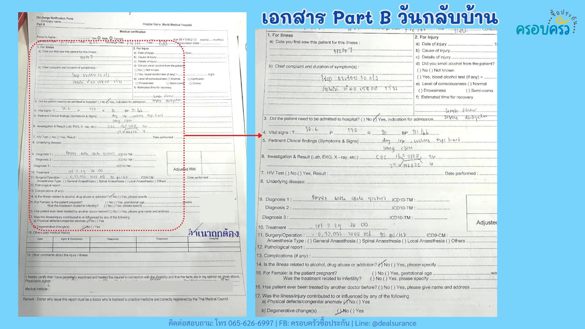 เงื่อนไขการแอดมิท โรคกลุ่ม simple disease
