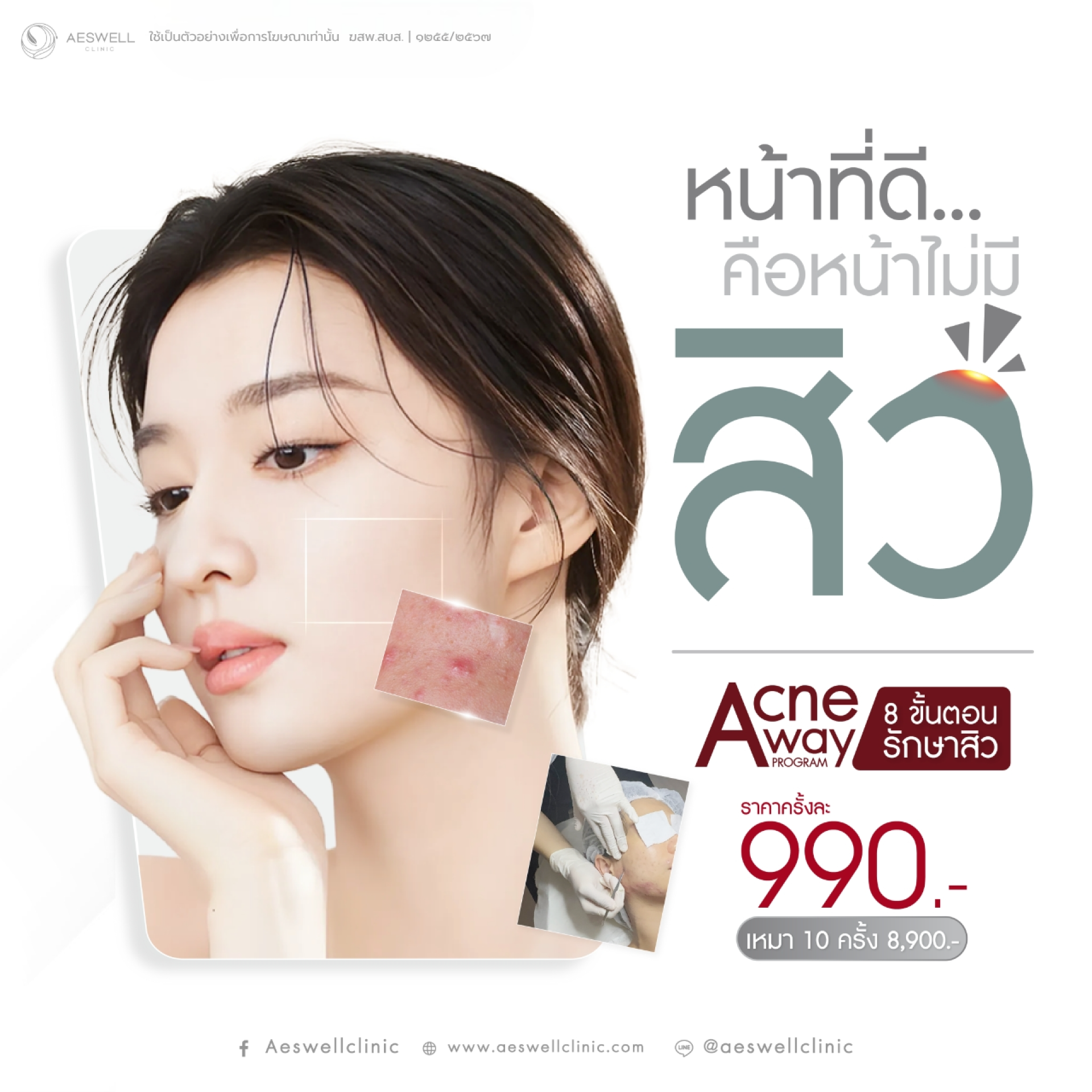 บริการรักษาสิวและยกกระชับปรับรูปหน้า ที่ Aeswell Clinic