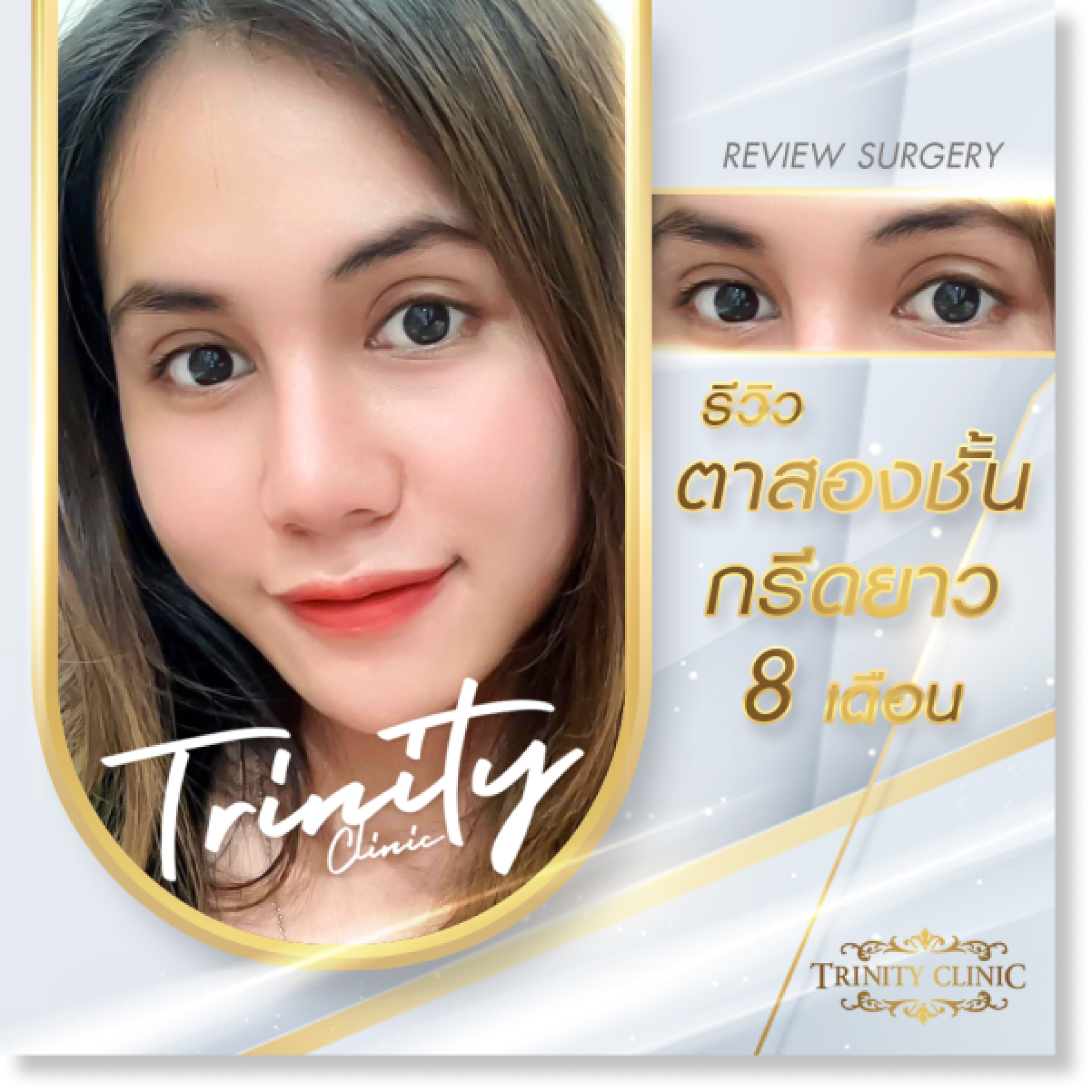 ศัลยกรรมตา - Trinity Clinic ทรินิตี้ คลินิก เสริมจมูก เสริมคาง
