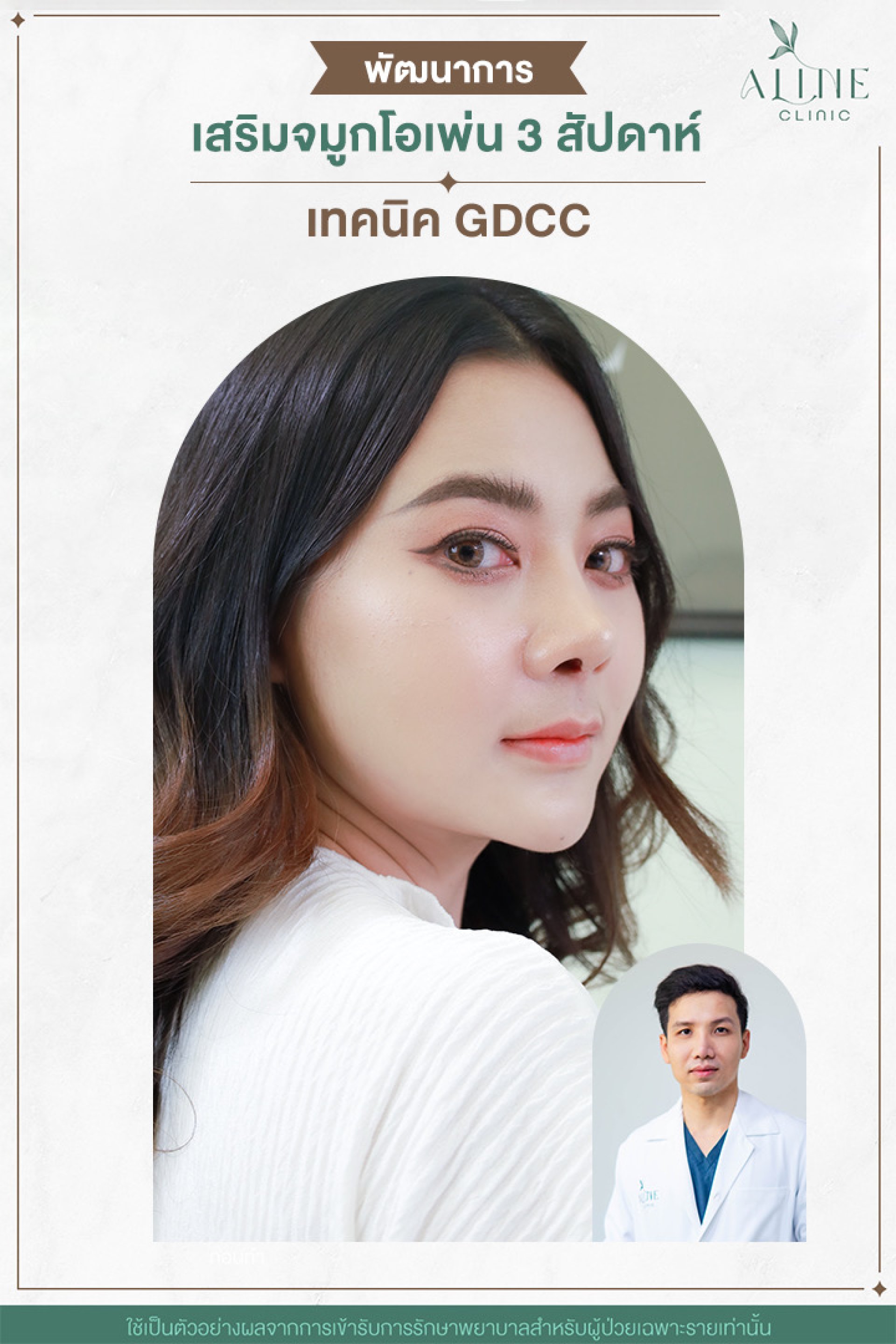 ALINE Clinic อลีนคลินิก ศัลยกรรมโคราช