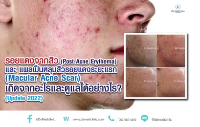 Program การดูแลผิวหน้า - demedclinic