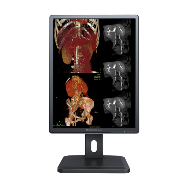 Hisense Monitor - HMD3C21S - simplexmedcare