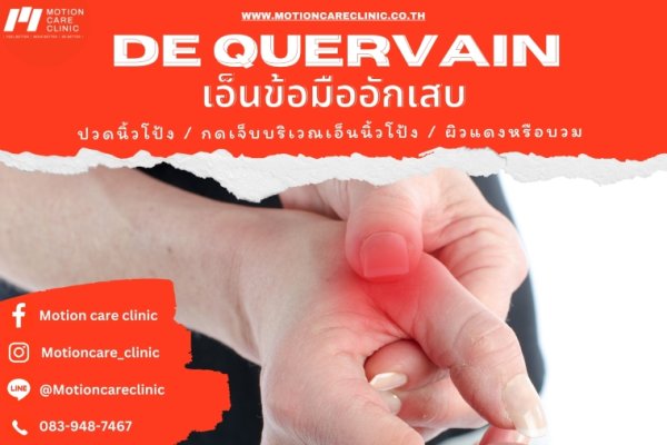 โรคเอ็นข้อมืออักเสบ (De quervain’s tenosynovitis) - motioncareclinic