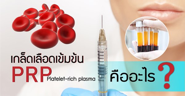 เกล็ดเลือดเข้มข้น PRP Platelet-rich plasma คืออะไร ? - demedclinic